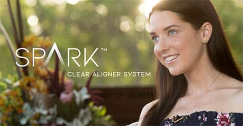 Spark Clear Aligner System in Atlanta & Alpharetta